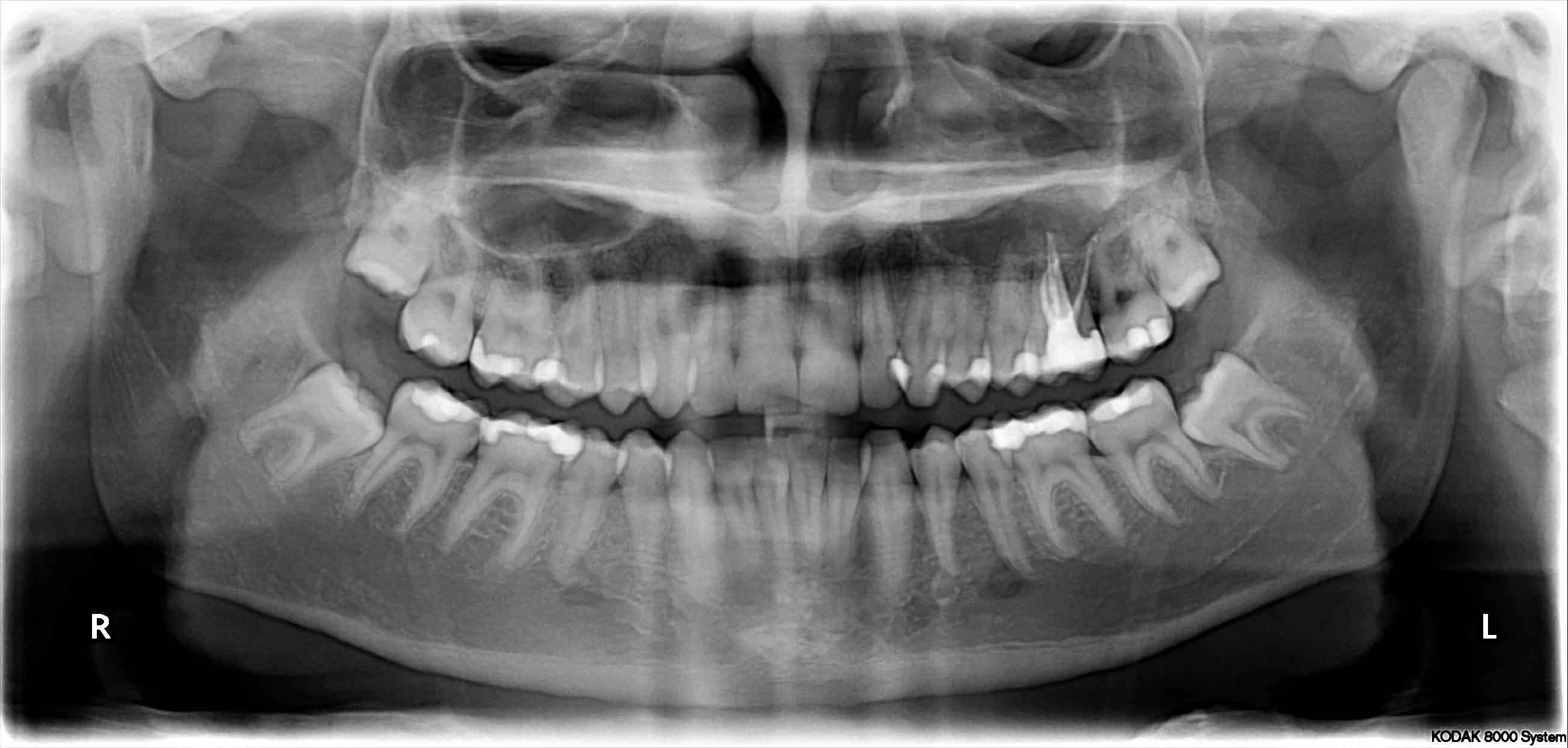 Gebit - Praktijk Solleveld